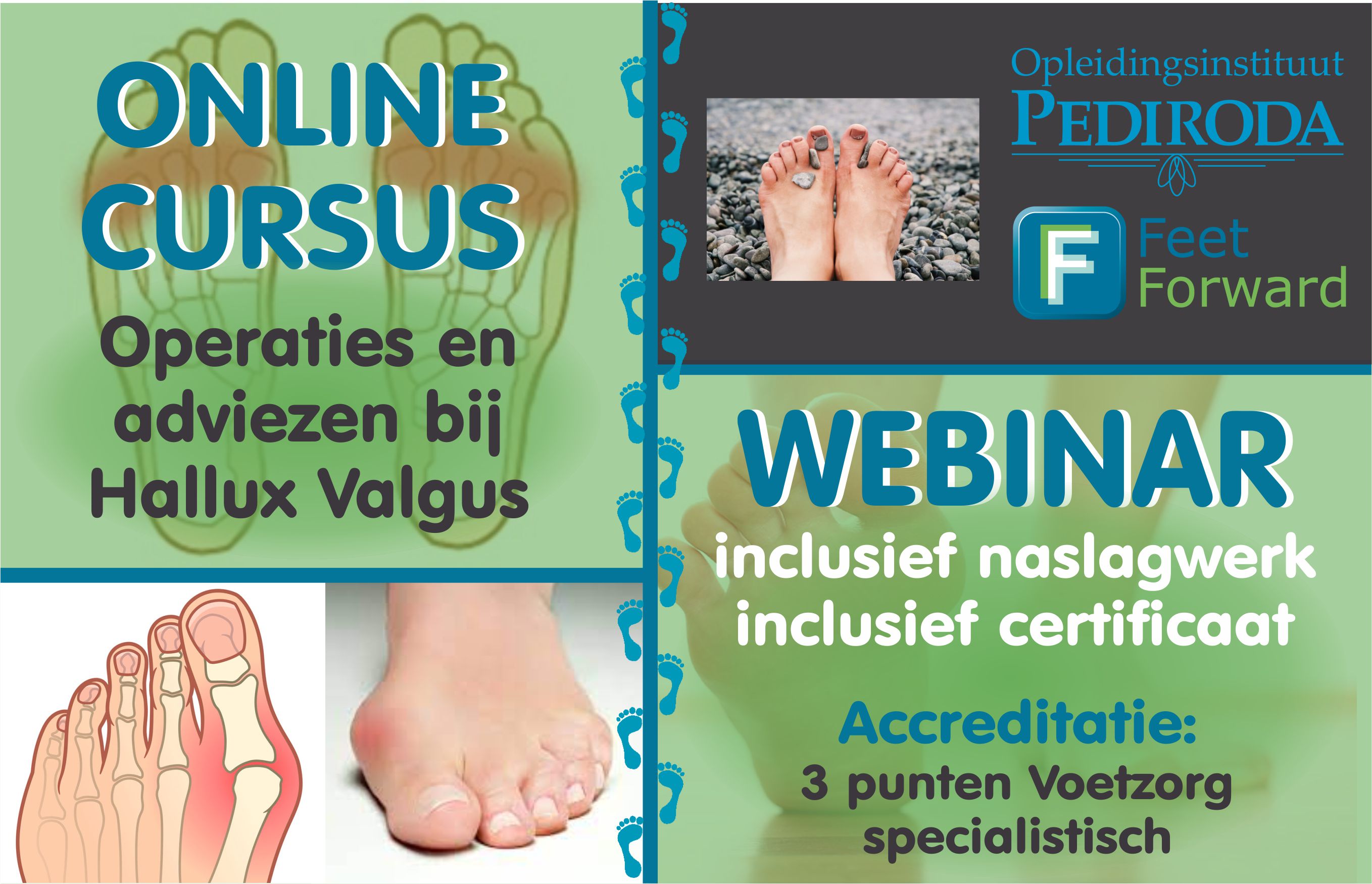 Operaties en adviezen bij Hallux valgus